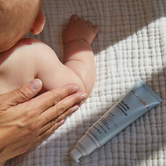 Understanding Eczema & Tips: How Stress Affects Your Skin – Evereden